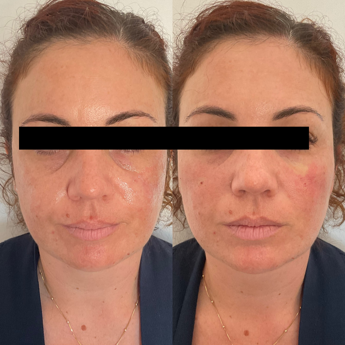 The Hive MedSpa - Botox Clinics El Paso, TX | Botox Services El Paso ...