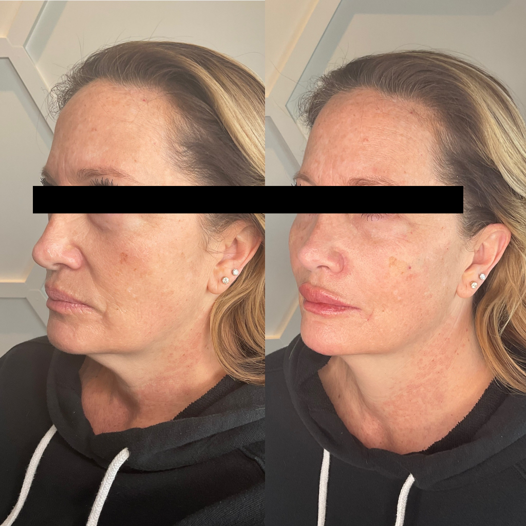 The Hive MedSpa - Botox Clinics El Paso, TX | Botox Services El Paso ...