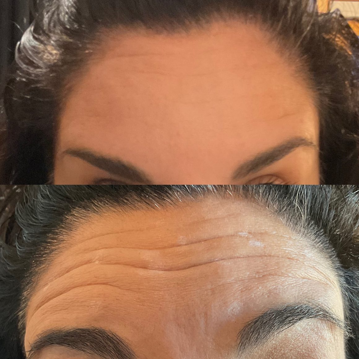 The Hive MedSpa - Botox Clinics El Paso, TX | Botox Services El Paso ...